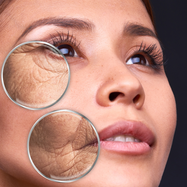 What Is Glycation and How Does It Affect Your Skin? - B-Box